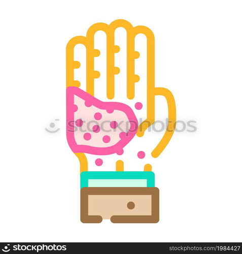 atopic dermatitis color icon vector. atopic dermatitis sign. isolated ...