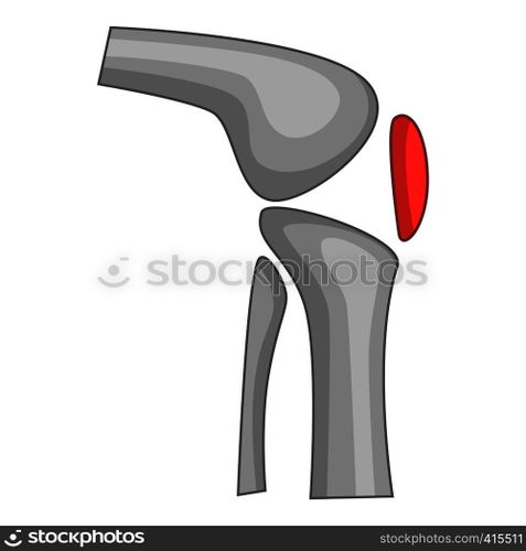Knee replacement implant icon. Cartoon illustration of knee replacement ...