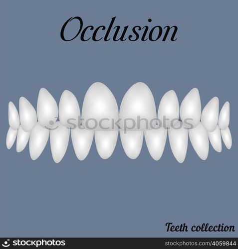 occlusion clenched teeth - bite, closure of teeth - incisor, canine ...