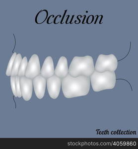 occlusion clenched teeth - bite, closure of teeth - incisor, canine ...