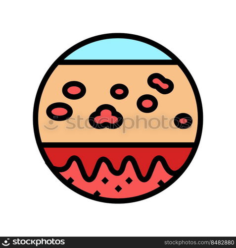 skin rashes hiv symptom color icon vector. skin rashes hiv symptom sign ...