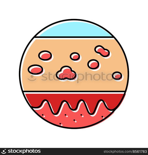 skin rashes hiv symptom color icon vector. skin rashes hiv symptom sign ...