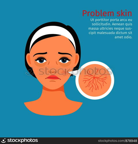 Woman face problem skin with buried capillaries, vector illustration ...